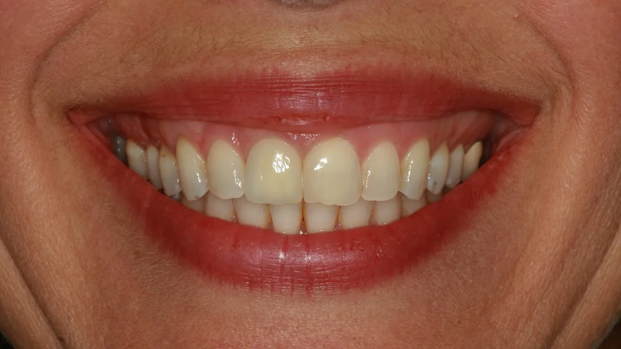 Smile Gallery Chicago IL, M. Nader Sharifi, DDS, MS