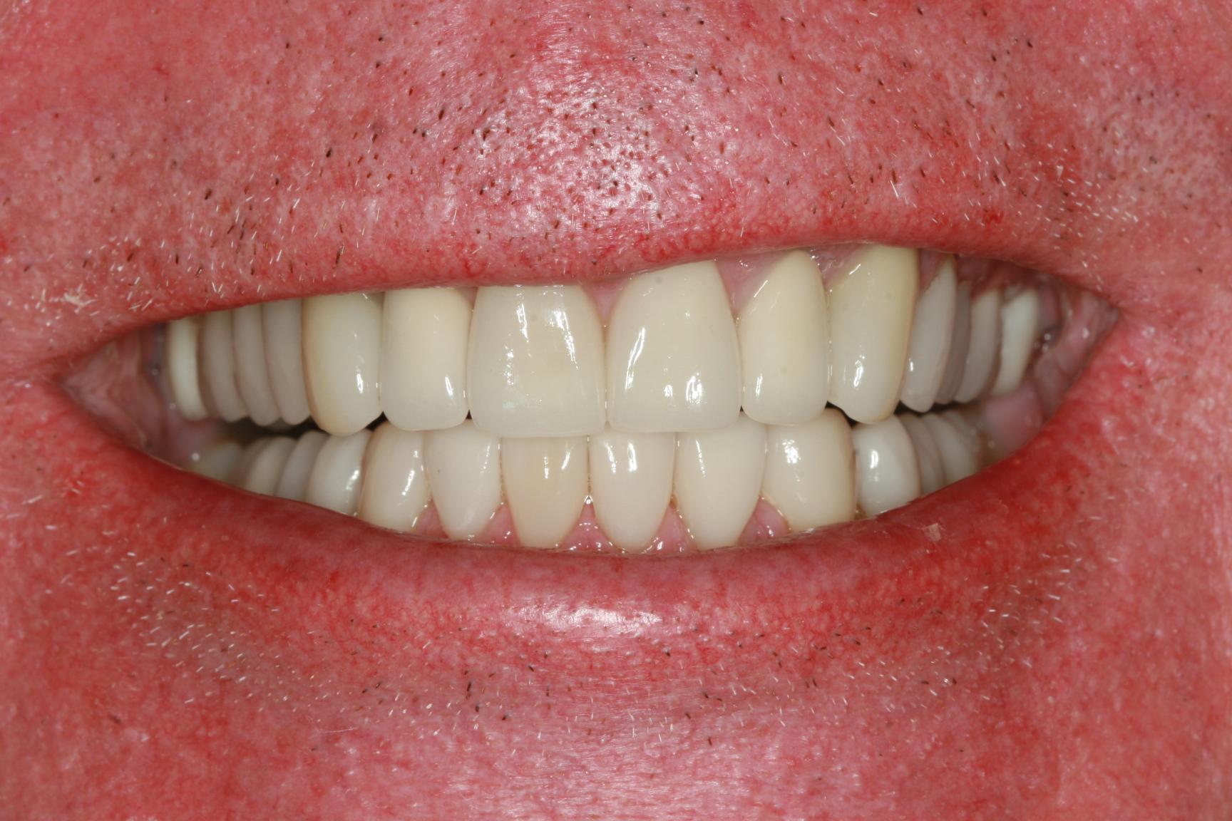 Smile Gallery Chicago IL, M. Nader Sharifi, DDS, MS